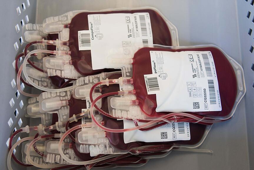 Blutspenden soll weiterhin gratis bleiben – und auch Schwule sollen uneingeschränkt spenden können